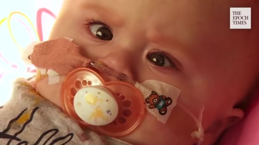 UK Baby Born With Heart Outside Body Allowed Home Visit | NTD