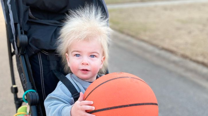 Boy with Rare Hair Condition Taught to be Proud of his Locks | NTD