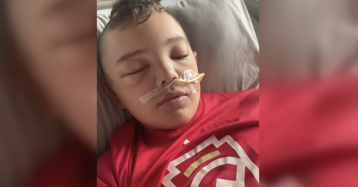 Injured Little Leaguer Has Increased Face Swelling Limiting His Vision ...