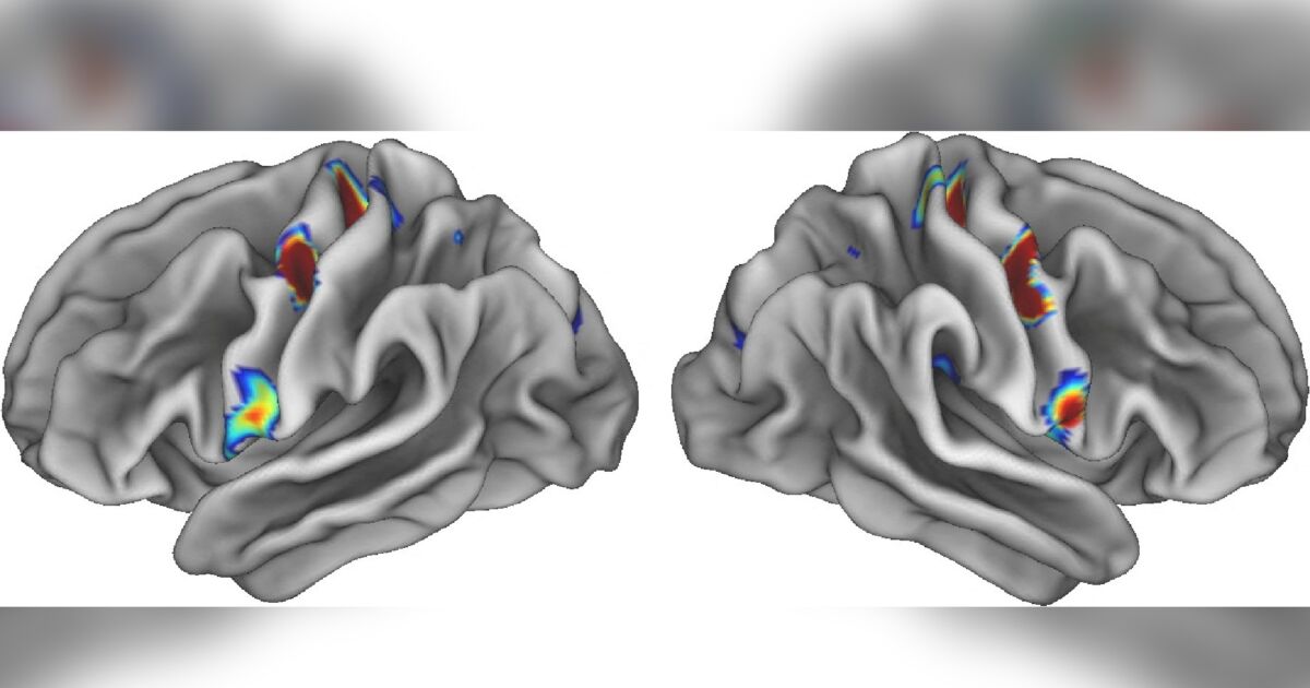 Scientists Identify Mind-Body Nexus in Human Brain | NTD
