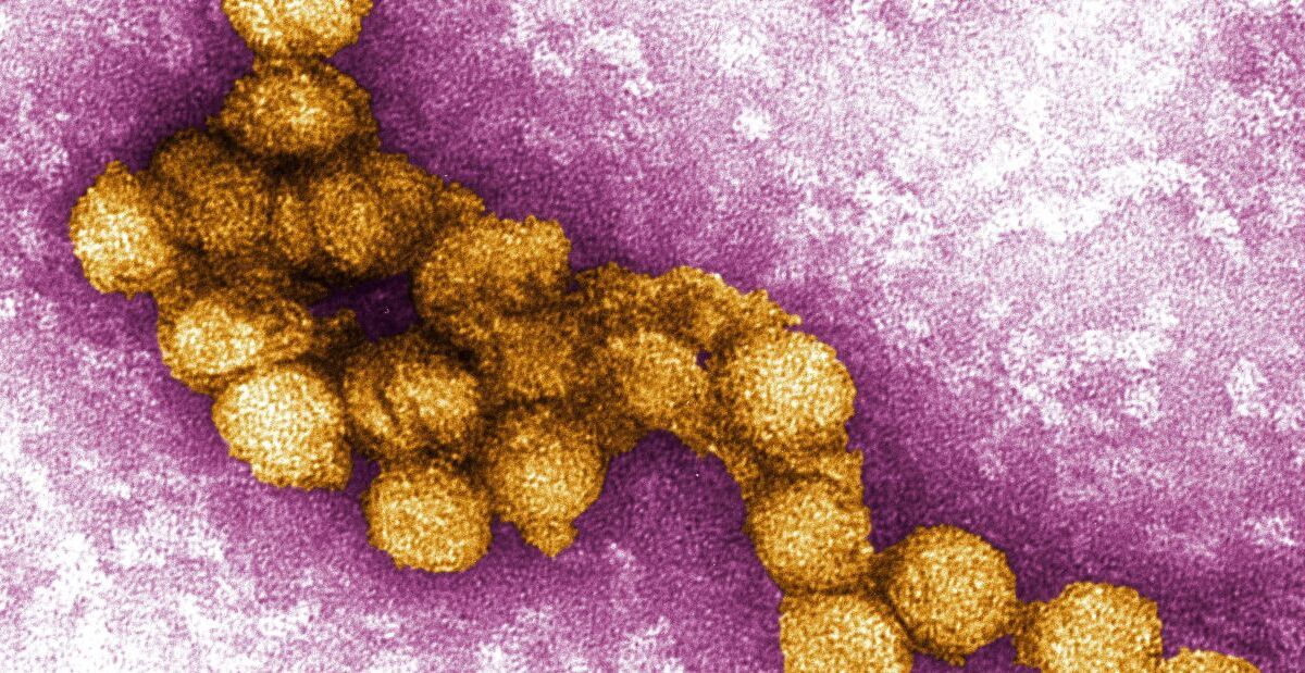 Officials Issue Alerts About Potentially Deadly Mosquito-Borne Virus ...