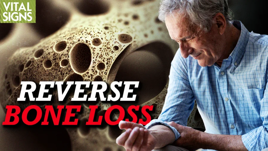 Treating Osteoporosis (Bone Loss): Medication, Micronutrients, Exercise ...