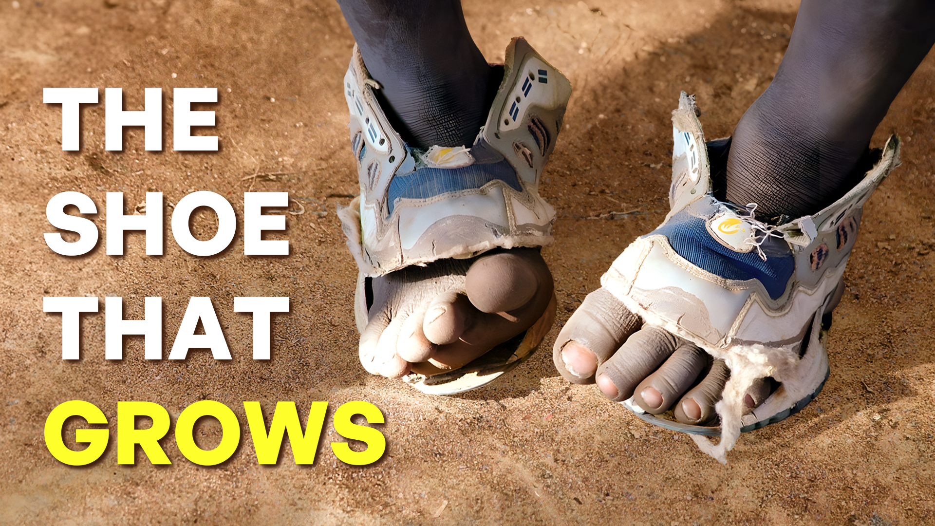 ‘The Shoe That Grows’–The Heartwarming Story of One Man Who Is ...